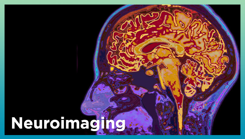 Neuroimaging Diagnostics | Children's Hospital Pittsburgh