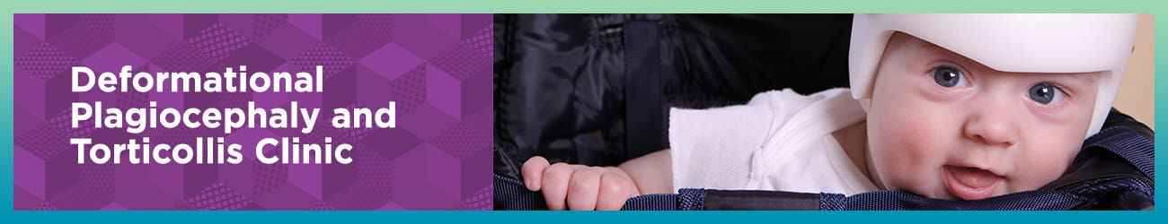 Deformational Plagiocephaly & Torticollis Clinic | Children's