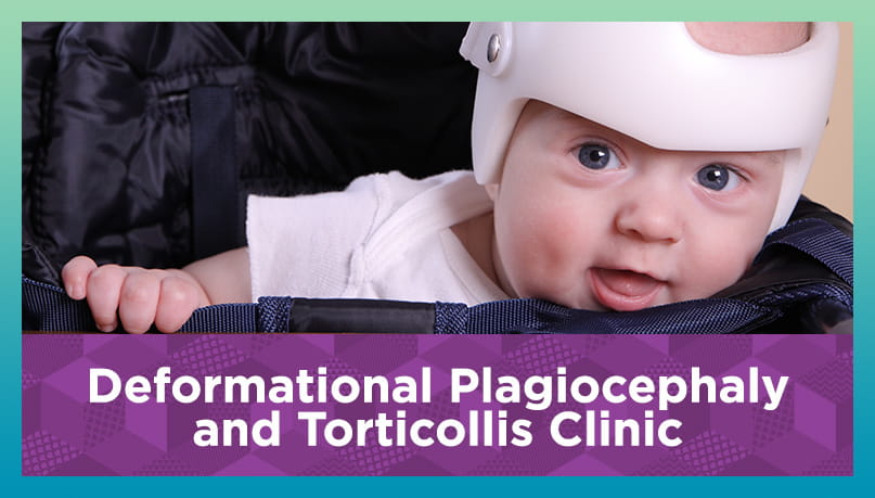Deformational Plagiocephaly & Torticollis Clinic | Children's