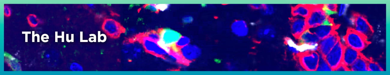 The Hu Lab | UPMC Children's Hospital of Pittsburgh