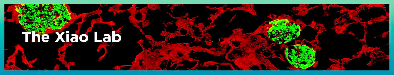 Xiao Lab for Diabetes Research | Children's Hospital of Pittsburgh