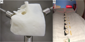 The 3-Dimensional Temporal Bone Dissection Manual: Operable Stepwise ...
