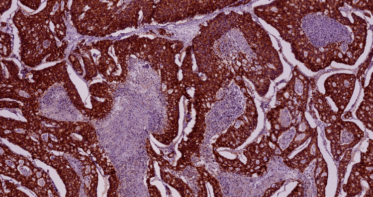 Rethinking Genetic Testing Guidelines: Study Reveals Significant ...