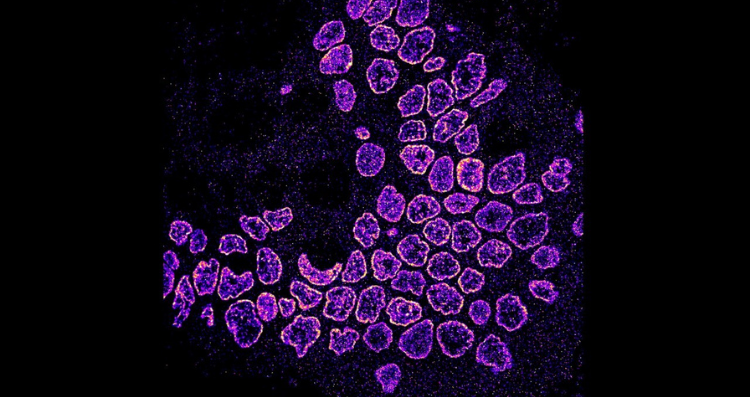 New Fluorescent DNA Label Reveals Nanoscopic Cancer Features | UPMC ...