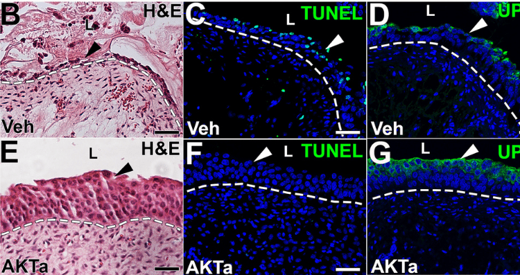 Role for KGF and AKT Signaling in Blocking Bladder Injury | UPMC ...