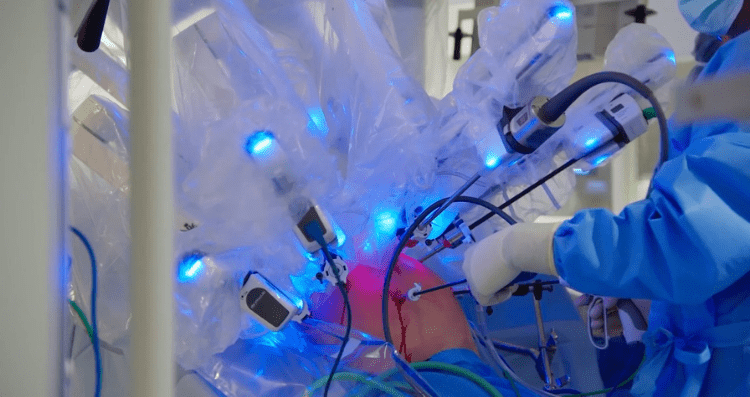Mastering the Robotic Whipple Procedure | UPMC Physician Resources