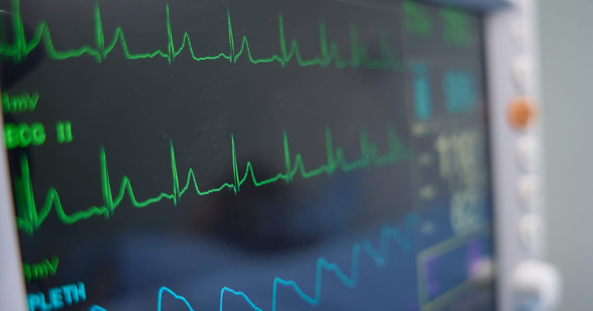 New AI Tool Beats Standard Approaches for Detecting Heart Attacks